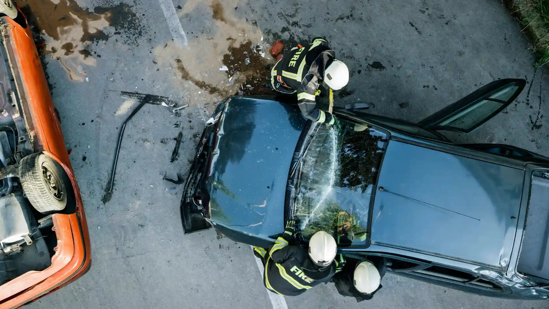 Broken Bones from a Car Accident in Lakewood, WA
